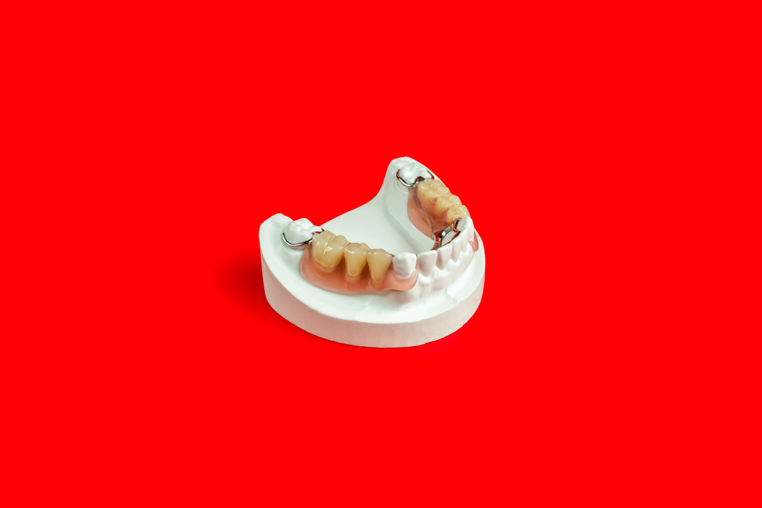 Prothèse adjointe partielle ou complète Valplast - Cosmident